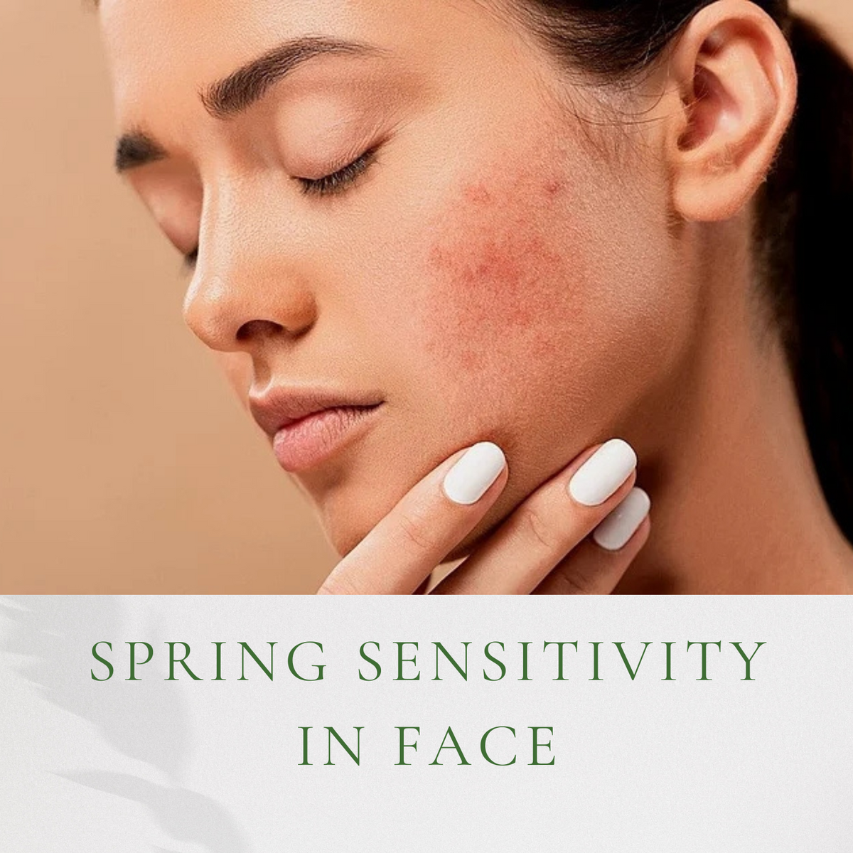 Spring Sensitivity in Face | Pelcas